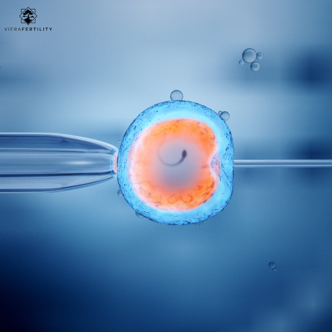 Understanding In Vitro Fertilization - Viera Fertility